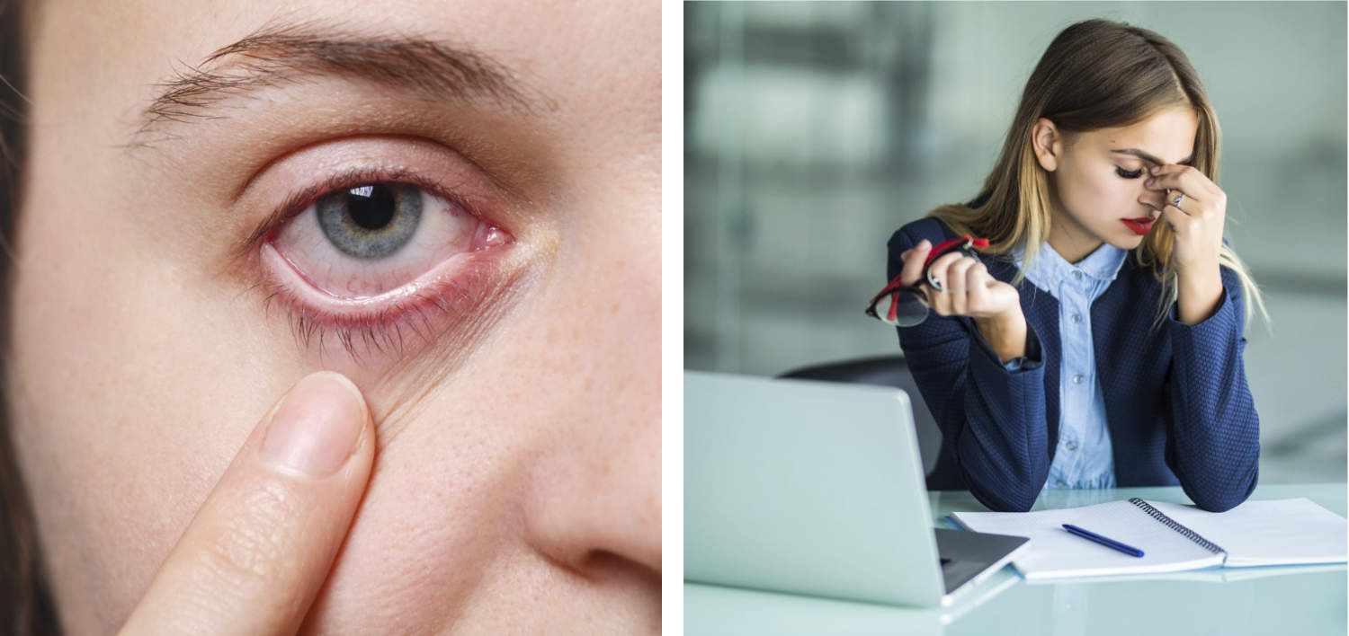 Sindrom suhog oka - Optika i Poliklinika Optotip Sisak